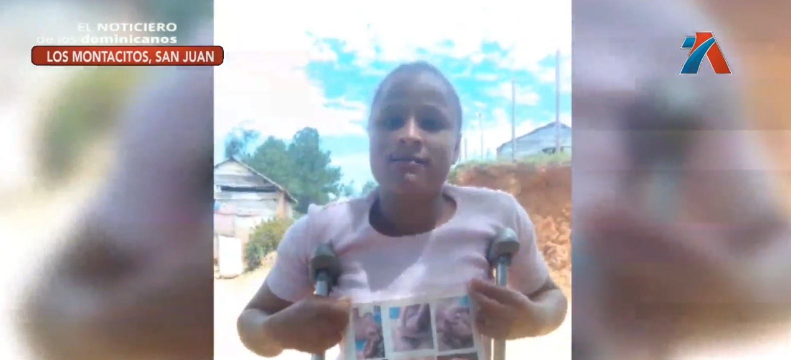 Joven con mielomeningocele necesita apoyo para cirugía urgente - Antena 7